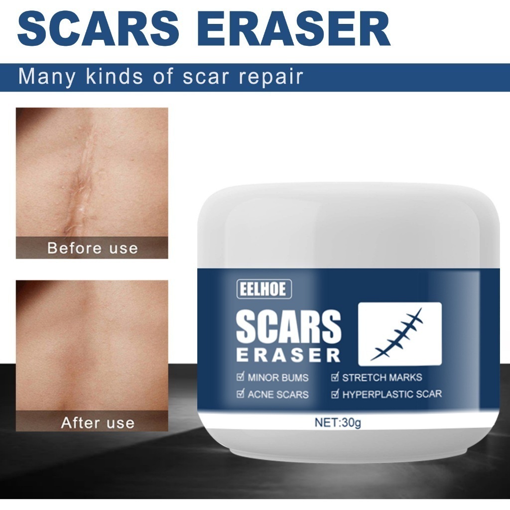 EELHOE SCARS ERASER ACNE SCARS Scar Remover Gel Cream Acne Treatment ...