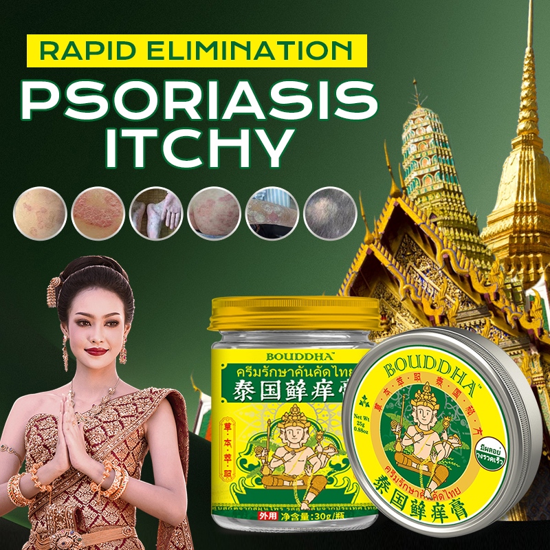 Thai Psoriasis Cream / Dermatitis Relief Cream/Anti Fungal/Eczema itchy ...