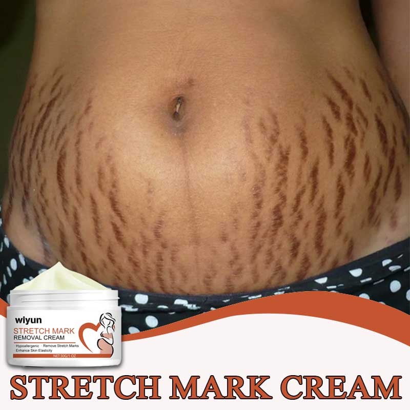 Stretch mark cream organic skin stretch mark anti stretch mark cream ...