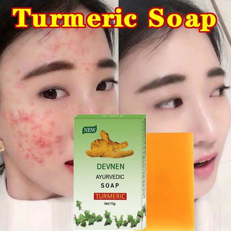 DEVNEN Turmeric Soap Whitening Original Acne Removal Ginger Soap ...