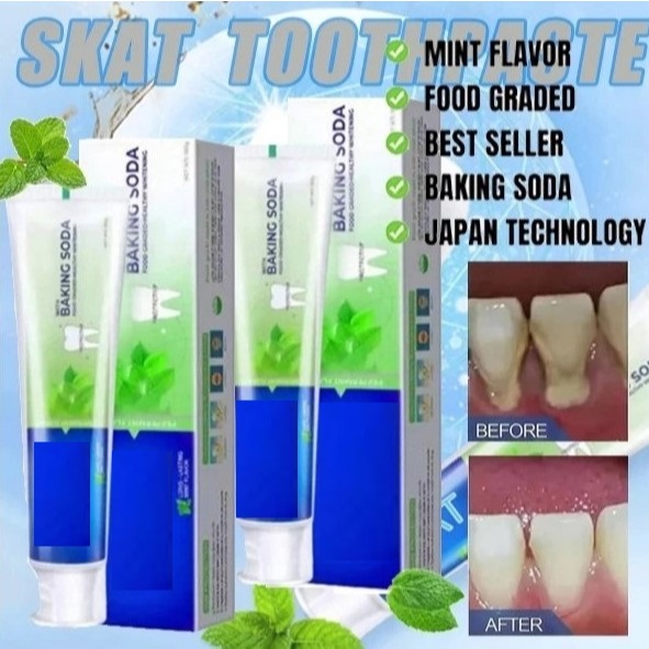 BUY 1 GET 1 TOOTHPASTE JAPANESE TECH 180g Whitening Peppermint Food ...