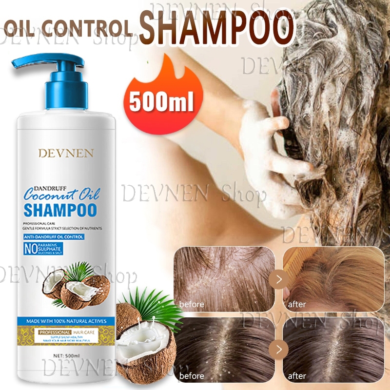 DEVNEN Coconut Oil Shampoo Anti Dandruff Repair Damaged Dry Frizz Hair Oil Control Refreshing ...
