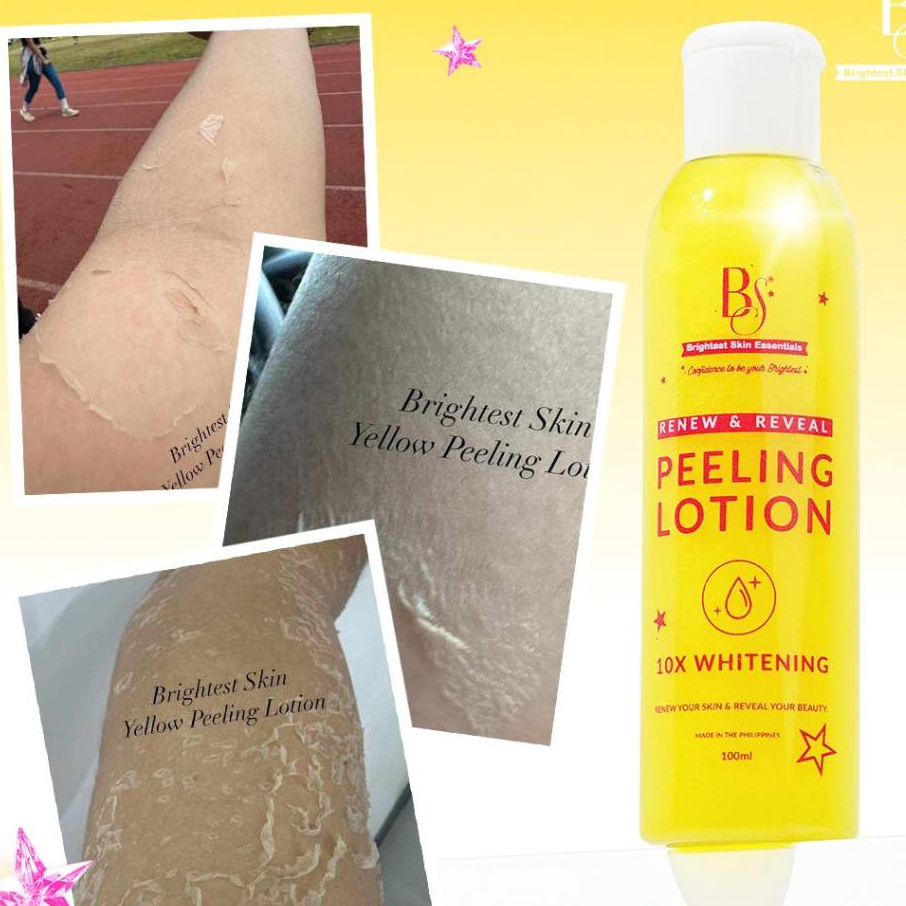 Brightest Skin Peeling Lotion 100ml | Shopee Philippines