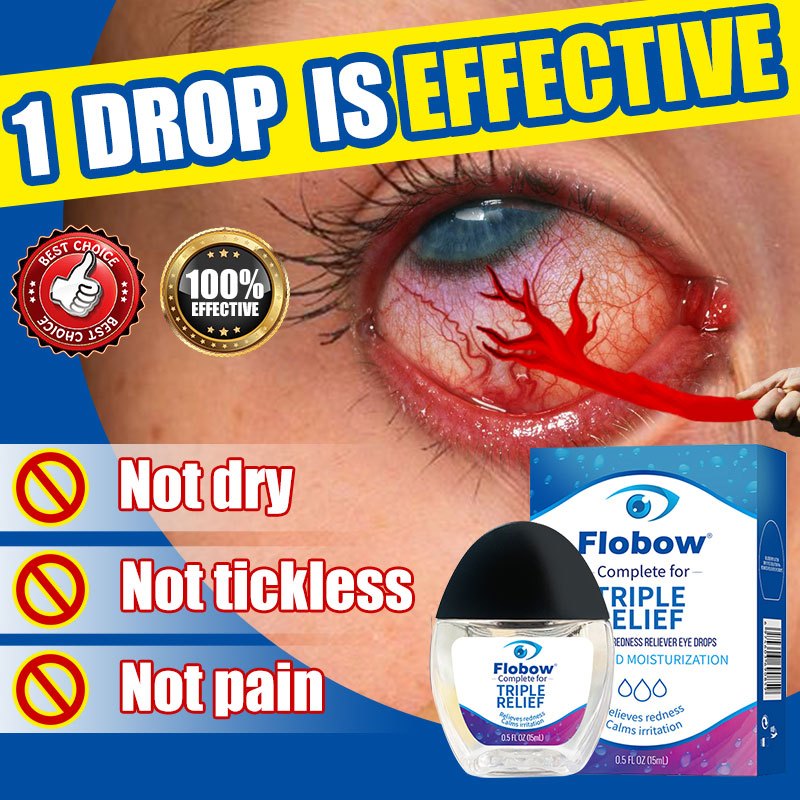 Flobow Eye Drops Itchy Relieves Dry Eyes Sore Red Eyes Discomfort ...