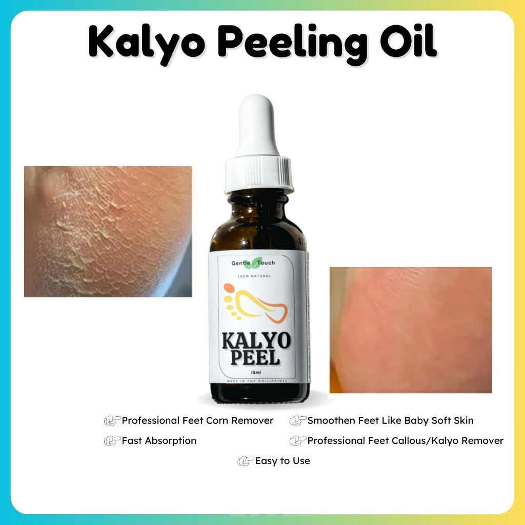 Gentle Touch | Premium Callous or Kalyo Remover Oil 15ml 100% Effective ...