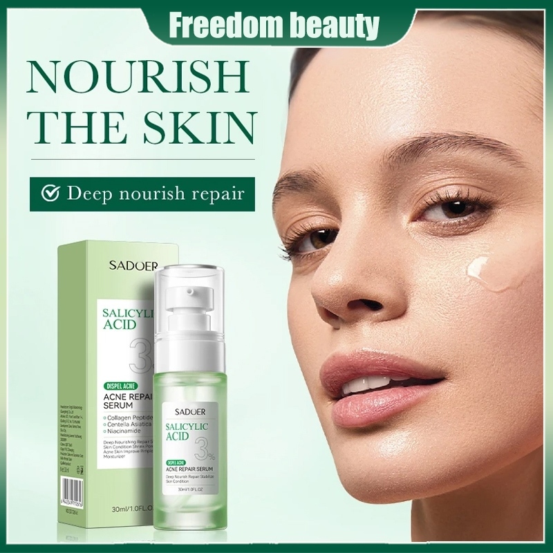 SADOER 3% Salicylic Acid Acne Treatment Serum Pimple Remover Anti Acne Marks Oil Control 30ml ...