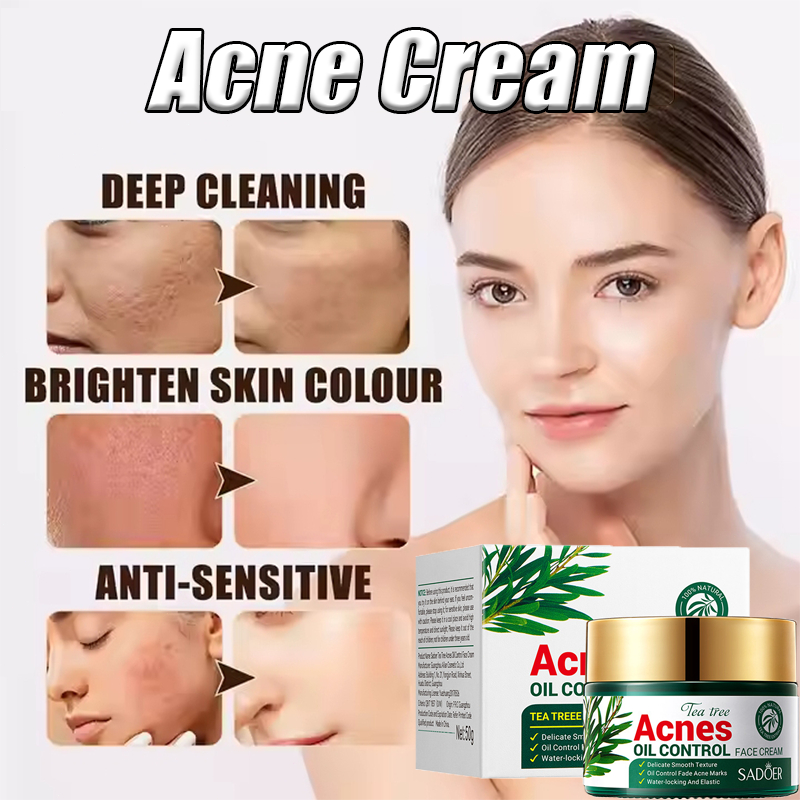 50g Acne Cream Moisturizing Skin Care Repair Acne Scars Acne Closed ...