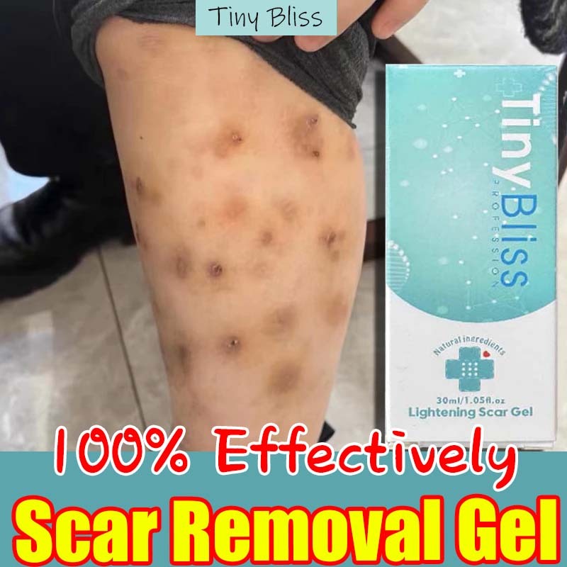 TinyBliss Lighten Up Lightening Baby Scar Gel Scar Remover Cream For ...