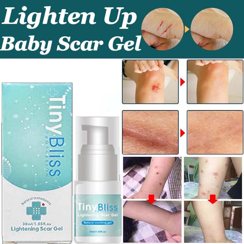 TinyBliss Lighten Up Lightening Baby Scar Gel Scar Remover Cream For ...