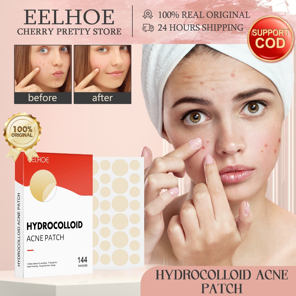 EELHOE Acne Patch 144pcs Invisible Acne Removal Hydrogel Acne Removing ...