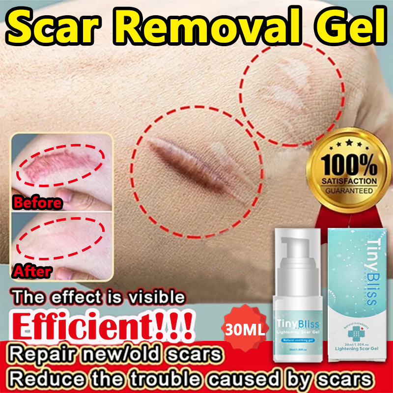 TinyBliss Baby Scar Gel Lighten Up Lightening Scar Remover Cream For ...