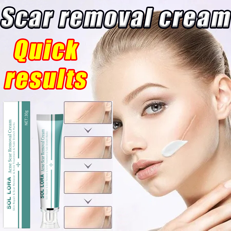Scar Remover Cream 30g Suitable For New And Old Scars To Promote ...