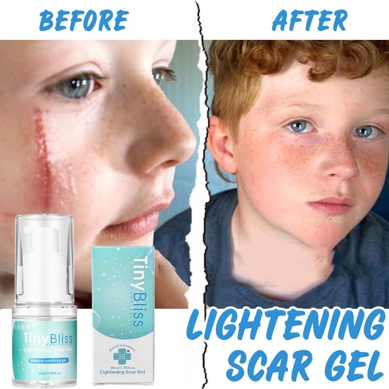 TinyBliss Scar Removal Cream For Kids Effective New And Old Scar ...