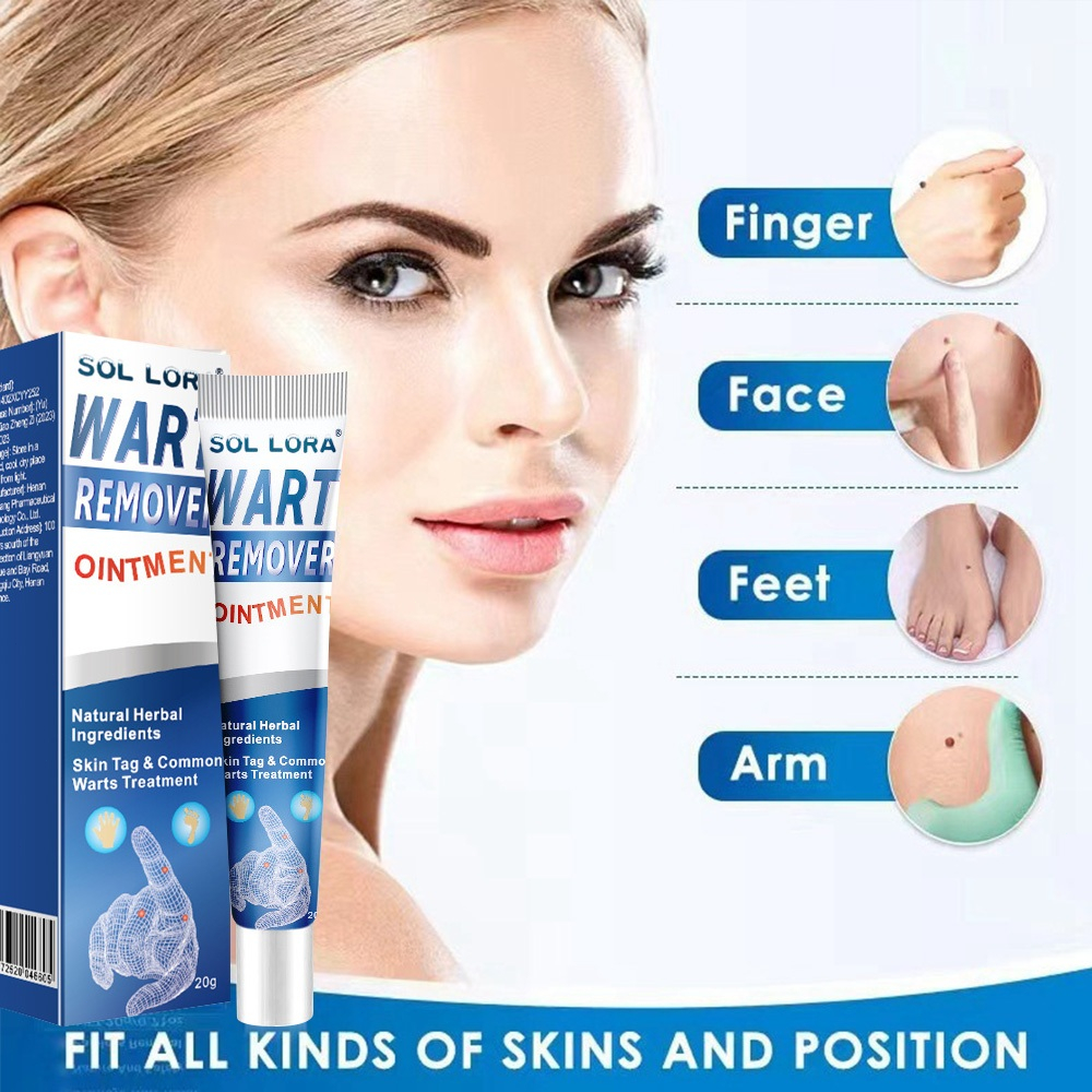 Warts Remover Cream Kulugo Treatment Ointment Skin Tag Mole Foot Corn ...