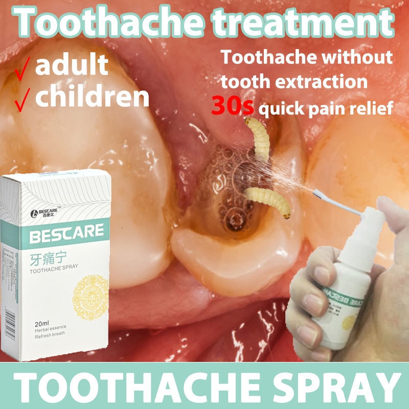 Toothache pain relief Gamot sa sakit ng ngipin Toothache spray 20ml ...