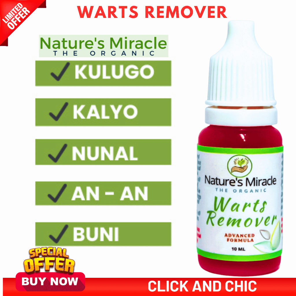 Original Kasoy Oil Wart Remover – Natural Warts & Skin Tag Removal ...