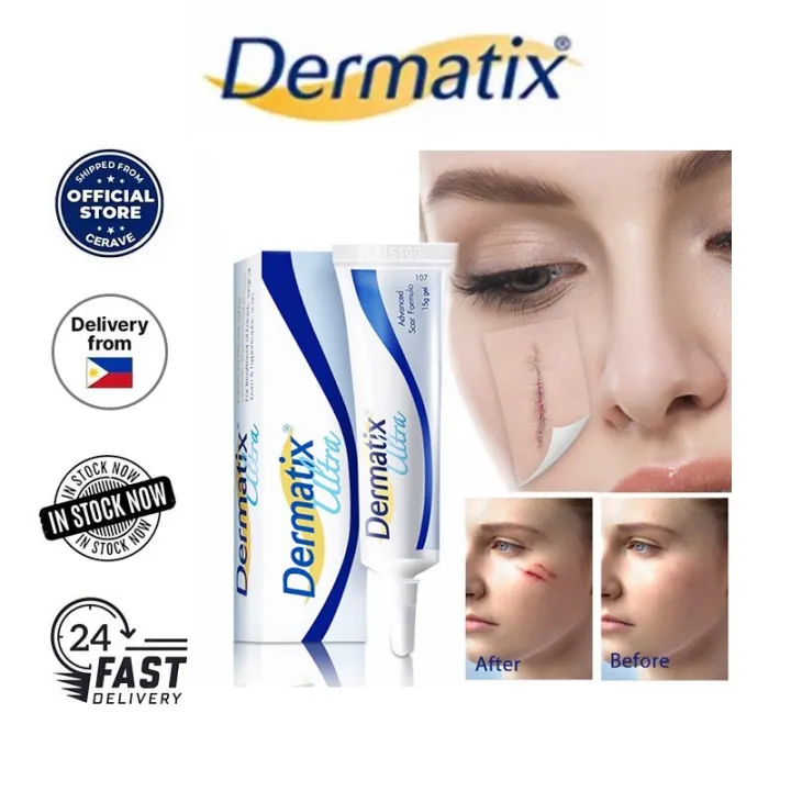 Dermatix Ultra Scar ointment Scar 15g Remover Gel Cream Scar Stretch ...