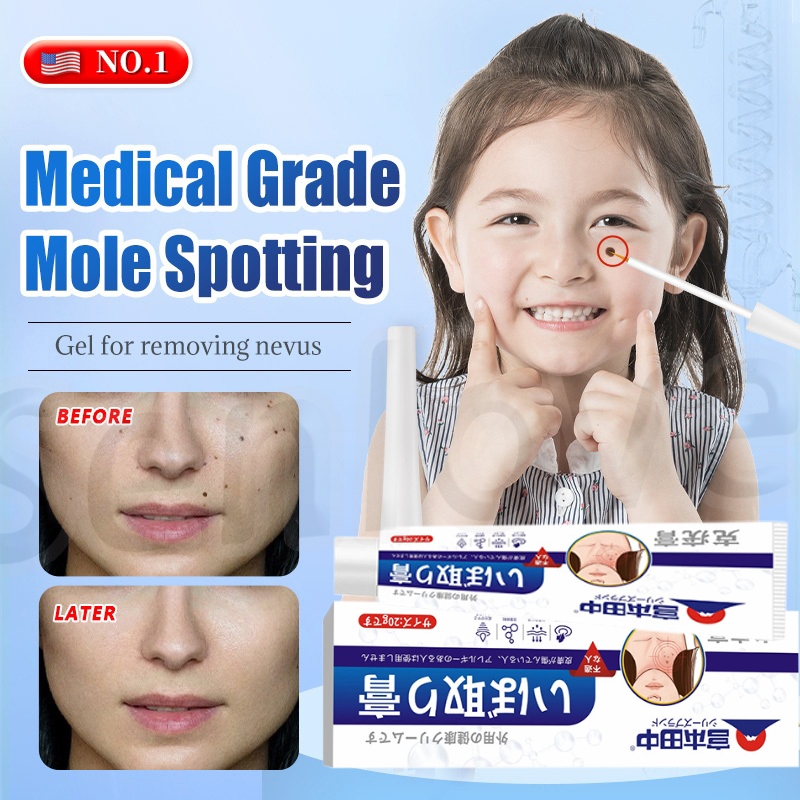 Warts Removal Cream Original Genital Warts Remover Mole Skin Tags ...