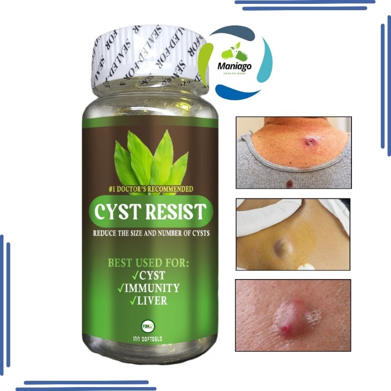 CYST RESIST Reduced Cyst Growth | Shopee Philippines