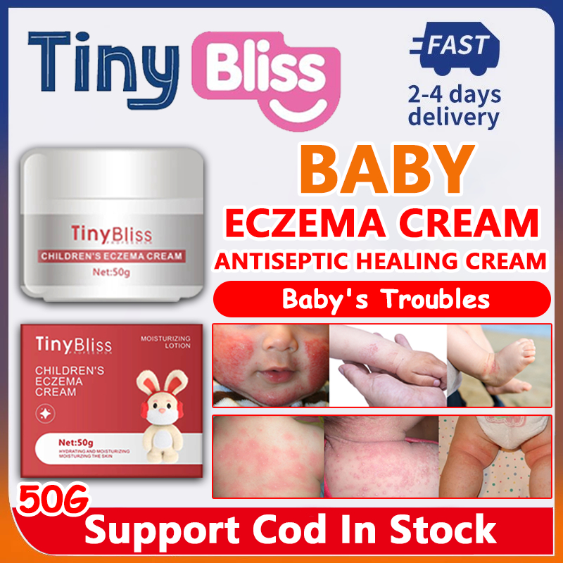 TinyBliss Eczema Cream For Baby Rushes Cream For Baby Cream Nappy Rash ...