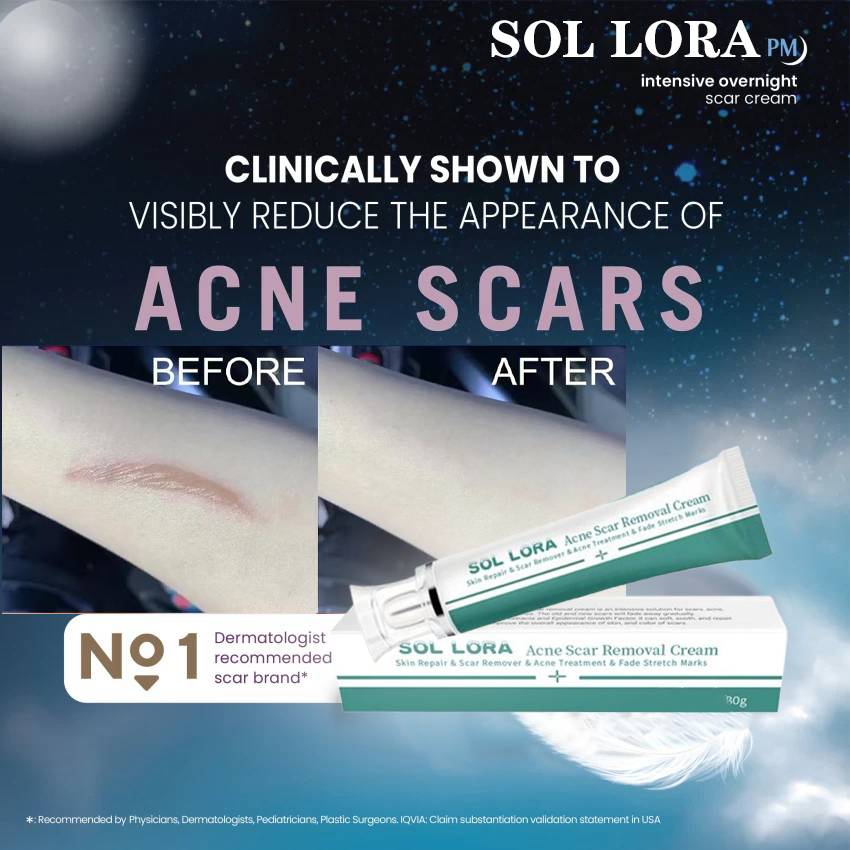 SOL LORA Keloid scar cream remover original fast acne scar remover Take effect in 7 days ...