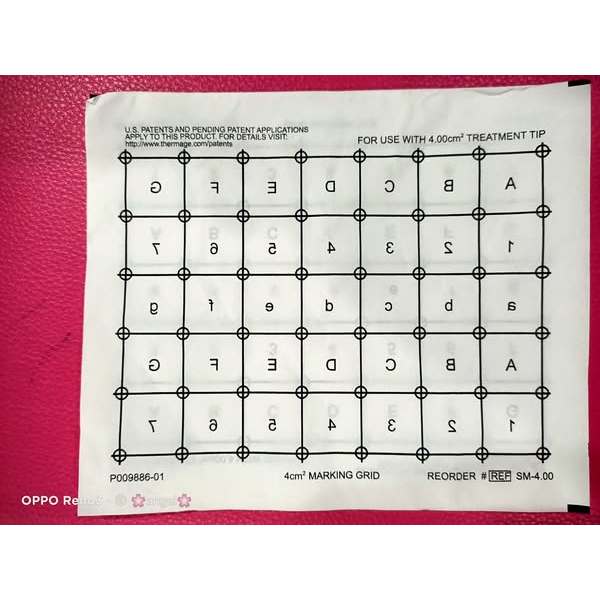 Thermage Grid Paper for RF Fractional Machine (for face and eyes ...
