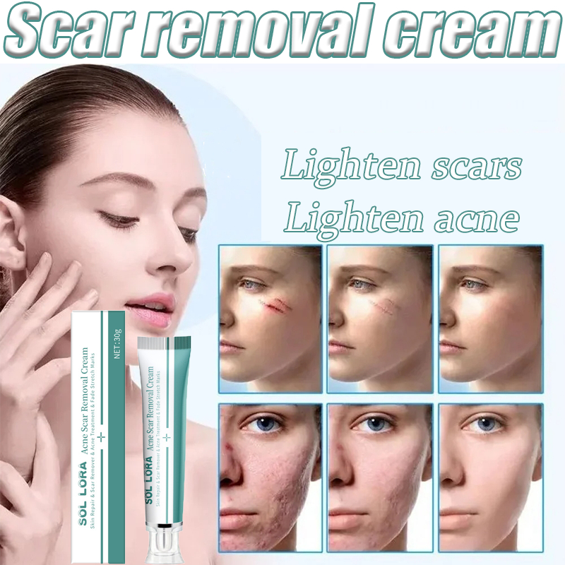 100% effective scar removal cream stretch mark removal cream is ...