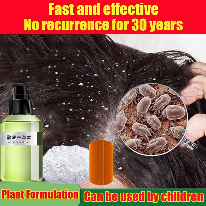 Lice Terminator Licealiz Shampoo Head Lice Teatment Lice Remover KWELL ...