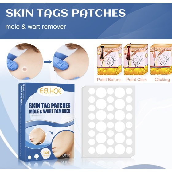 144 Acne Patches Skin Tag Patch Mole Wart Remover Acne Wart Waterproof ...