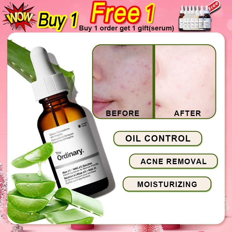 The Ordinary Aloe 2% + NAG 2% Solution face serum A soothing solution for post-acne marks ...