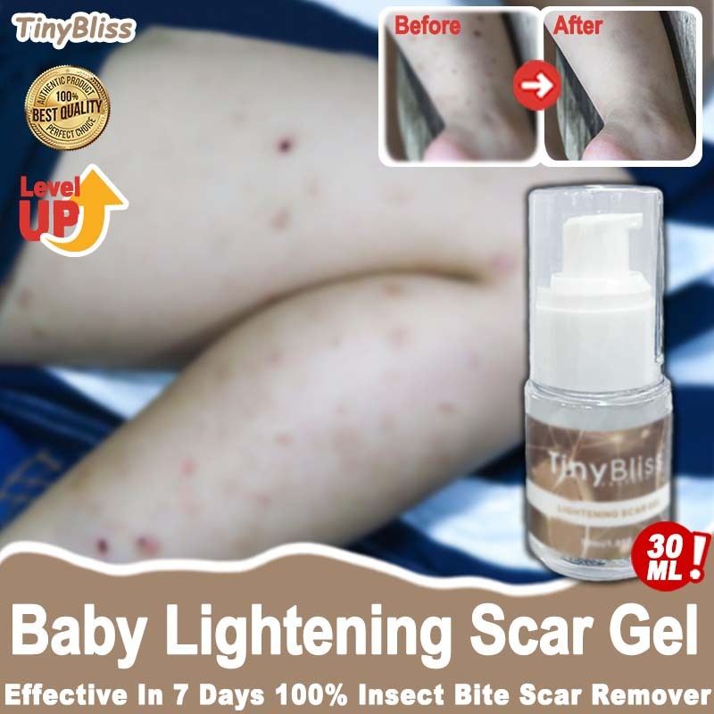 Tiny Bliss Baby Scar Remover Cream Original 30ml Peklat Remover Gel For ...