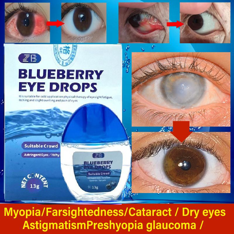 Blueberry eye drops original clear eye sight drops Treatment cataract ...