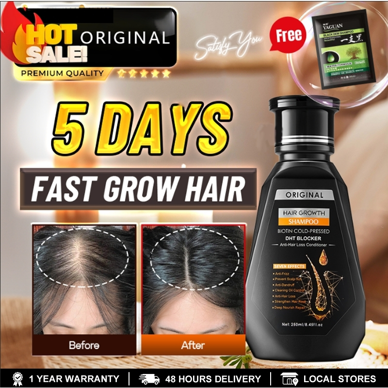 Original Ginger Shampoo Hair Grower Hair Growth Horse Shampoo Ng Kabayo ...