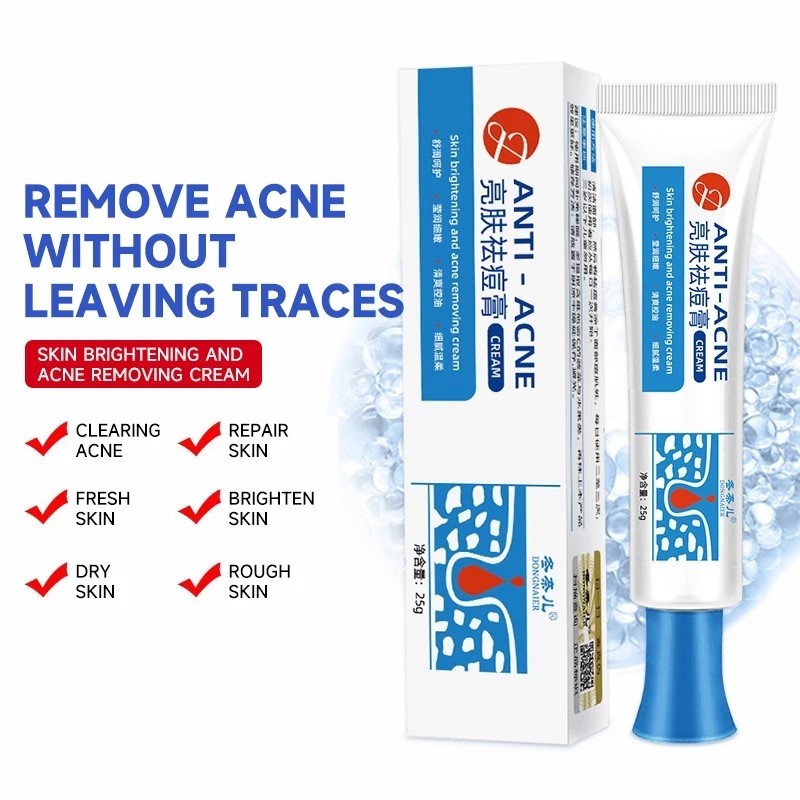 Acne Remover Cream 25g Pimple Marks Remover Cream Acne Treatment Acne ...