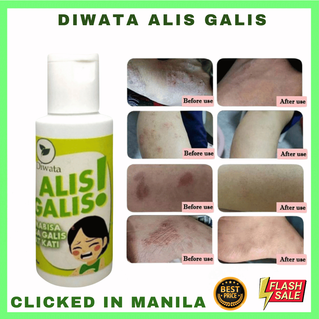 Alis Galis Original Ointment for Itchy Skin - Fast-Acting Treatment for ...