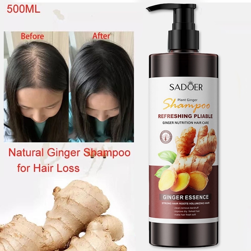 Ginger Shampoo Buy 1 Take 1 Anti-Hair Loss Strengthens Hair Anti ...