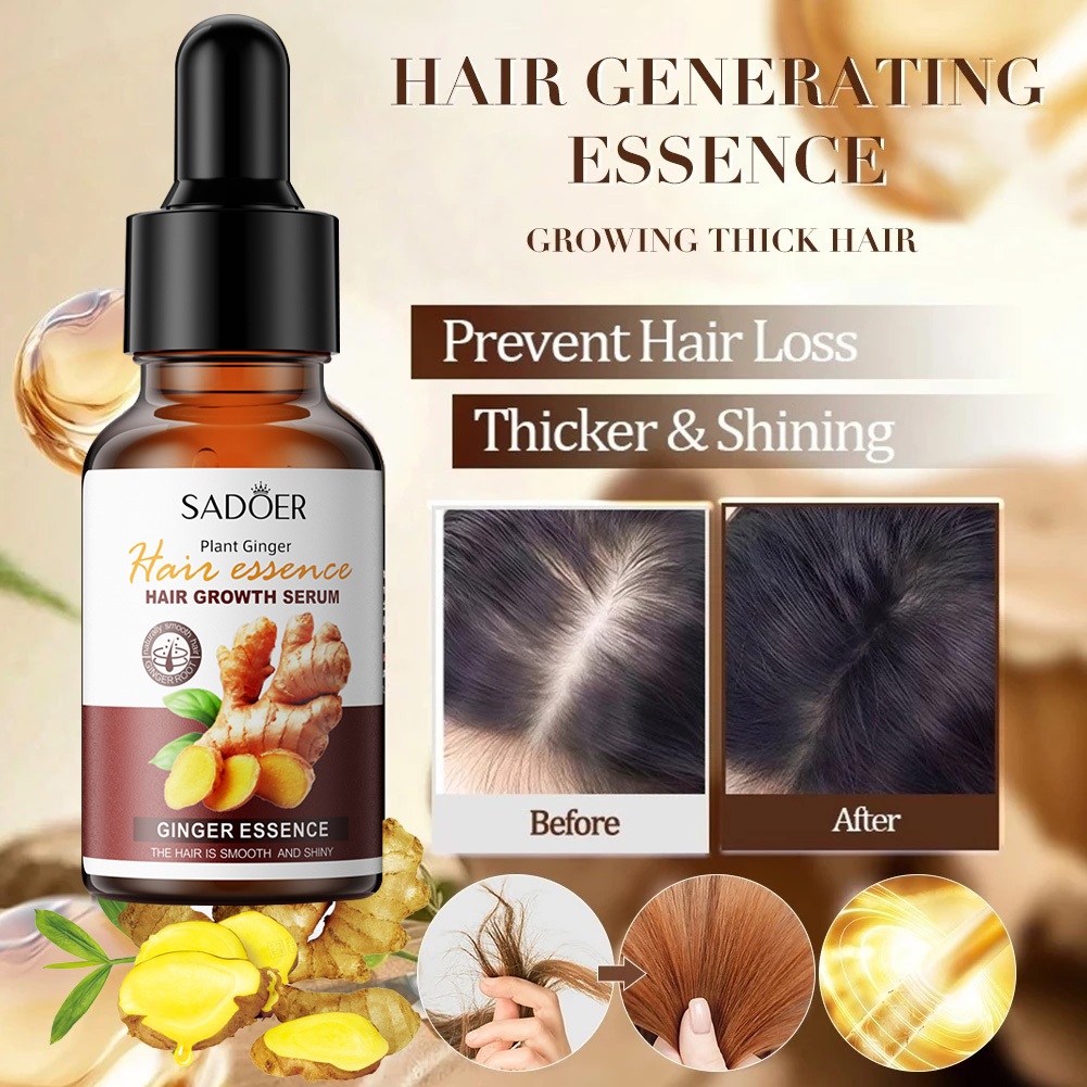 SADOER Hair Growth Serum Anti Hair Loss Anti-Frizz Hair Growth Essence ...