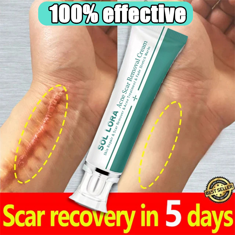 Scar Removal Cream Removal Mosquito Bite Keloid Old Black Burn Acne 100 ...