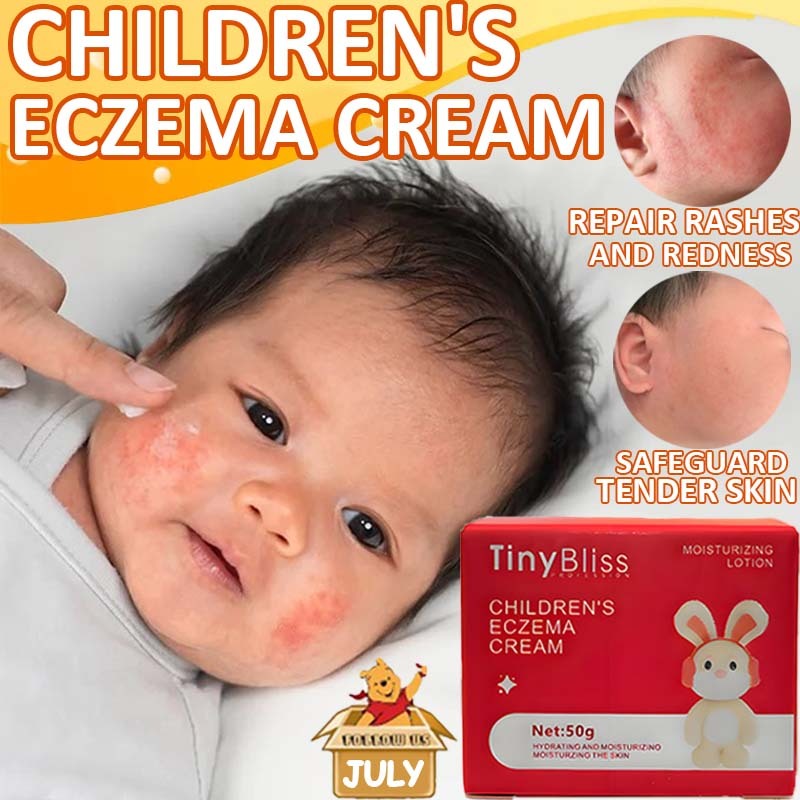 TinyBliss Baby Eczema Cream Diaper Rash Cream Baby Anti-Rash Cream50g ...