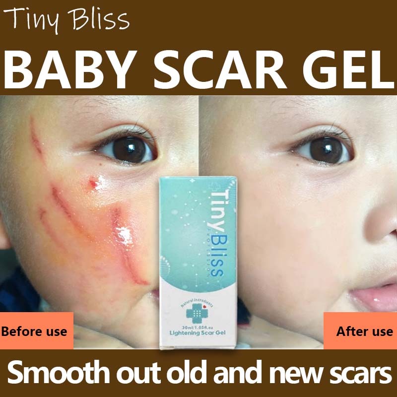 TinyBliss Baby scar remover Baby Scar Gel Baby lightening scar gel Scar ...