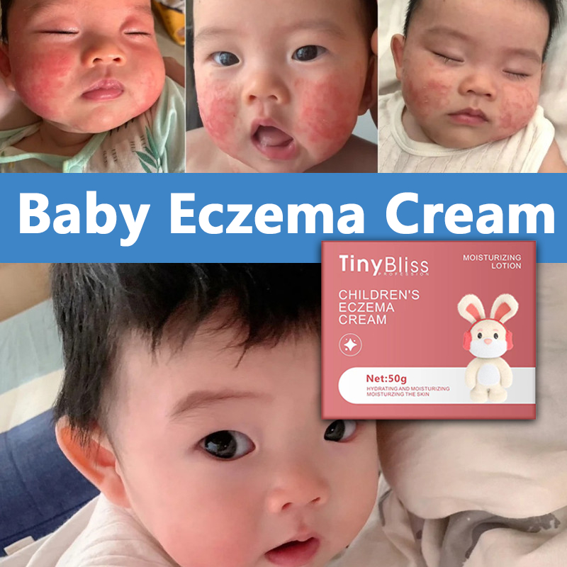 TinyBliss Natural Nappy Cream Baby Eczema Cream Relieves Rashes And ...