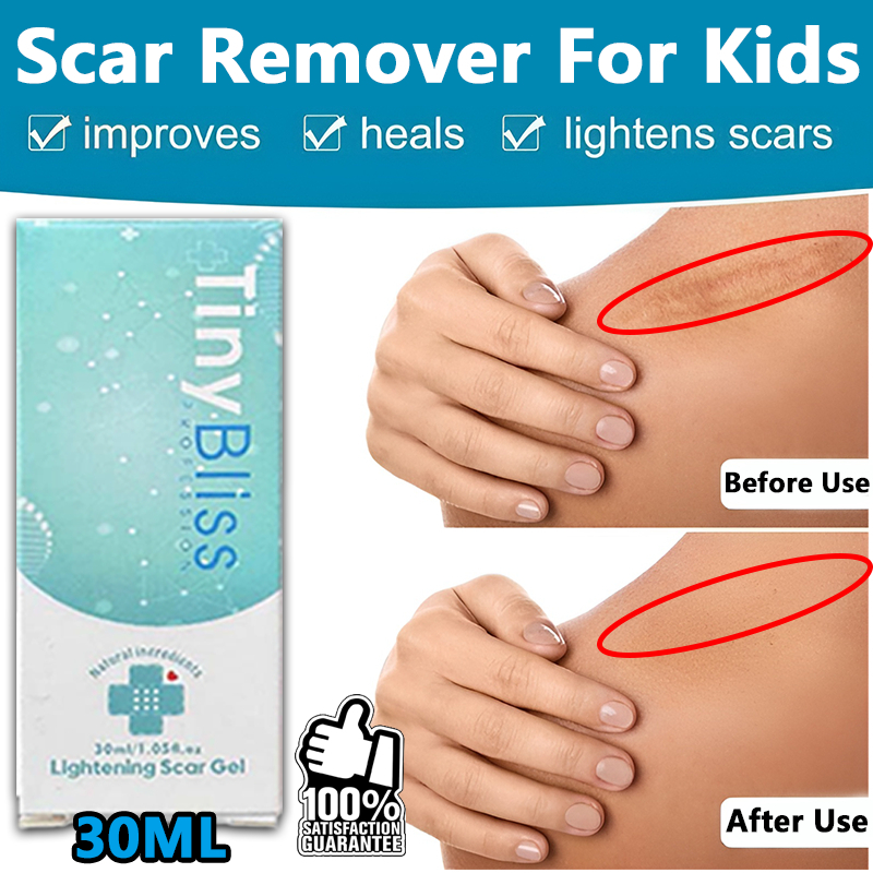 TinyBliss Lightening Scar Gel For Baby Scar Remover Cream For Kids 30ML ...
