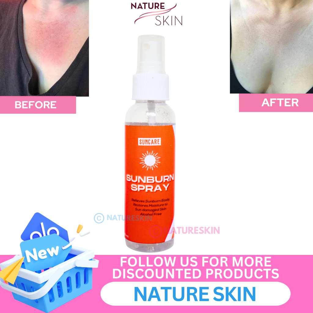 Sunburn Spray 100ml Sun Protection Sunblock damaged skin Treatment ...
