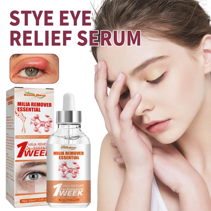 Eye Milia Removal Cream 30ml Fat Granules Removal Eye Serum Eye Milia ...