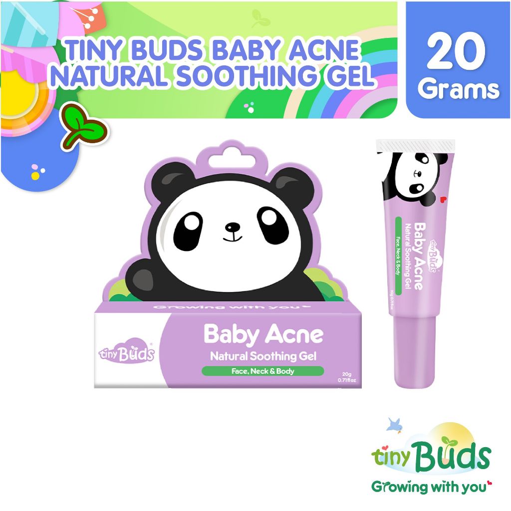 Tiny Buds Baby Acne Natural Soothing Gel [FS] | Shopee Philippines
