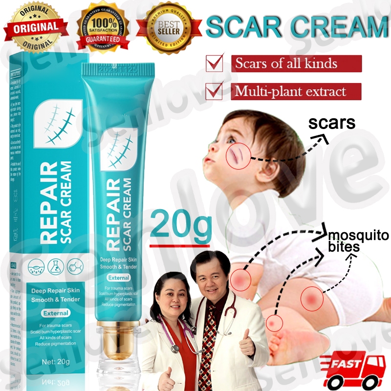 Scar Removal Cream Stretchmarks Remover Peklat Remover Cream For Leg ...
