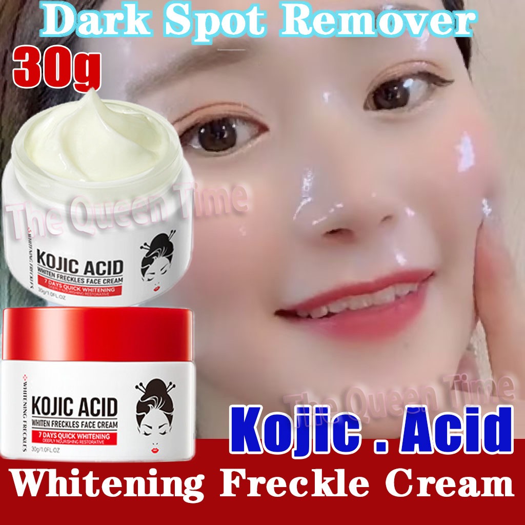 Kojic Acid Whitening Freckle Cream Melasma Cream Pekas Remover Anti ...