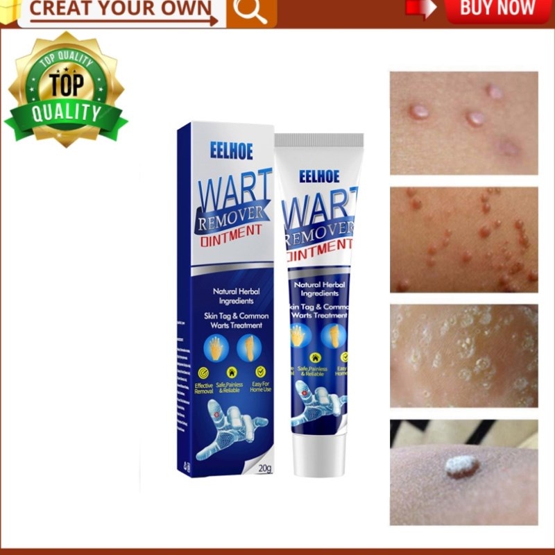 1/2PCS Warts Remover ORIGINAL Skin Tags Mole Remover Corn Plantar Wart ...