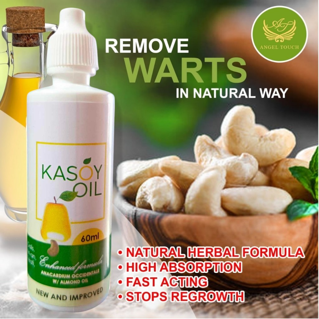 Original Angel Touch Kasoy Oil & Kasoy Cream para sa warts handcare ...