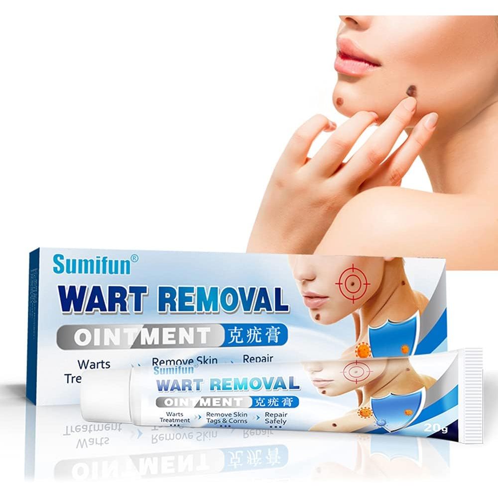 COD Wart Removal Ointment Cream Common Wart for Body Skin Tag Remover ...